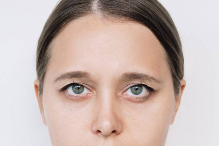 What Causes Ptosis? | Jennifer Murdock MD